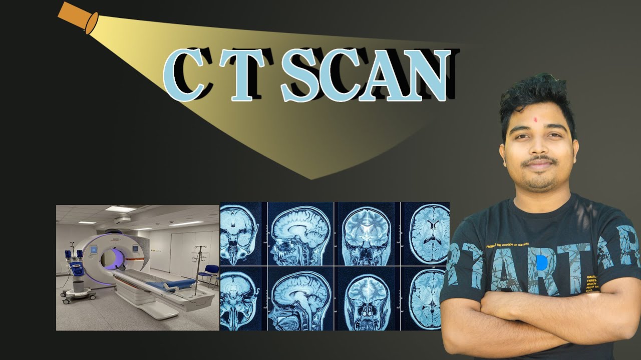 CT scan || whai is CT scan mechanism of CT scan || use of CT scan - YouTube