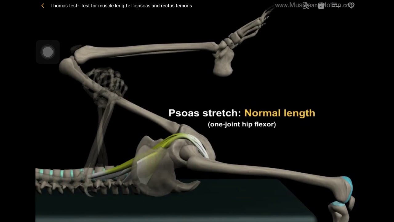 Thomas Test Assessment Of Hip Flexors Length Youtube