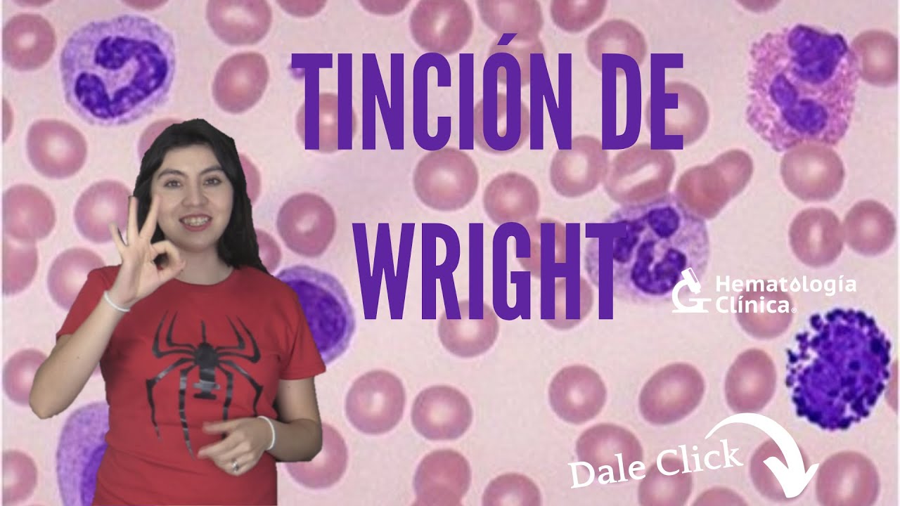 Tincion de wright - YouTube