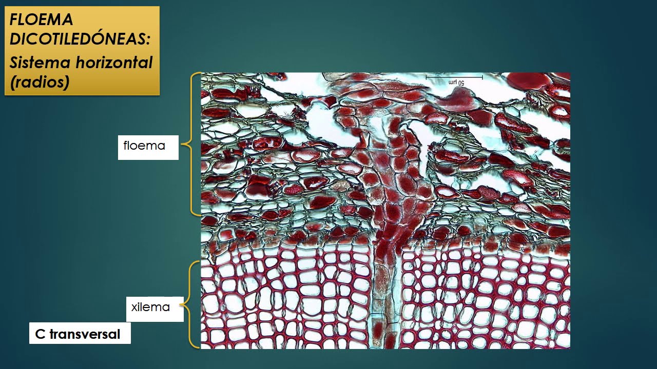 Unidad 17. Floema secundario - YouTube