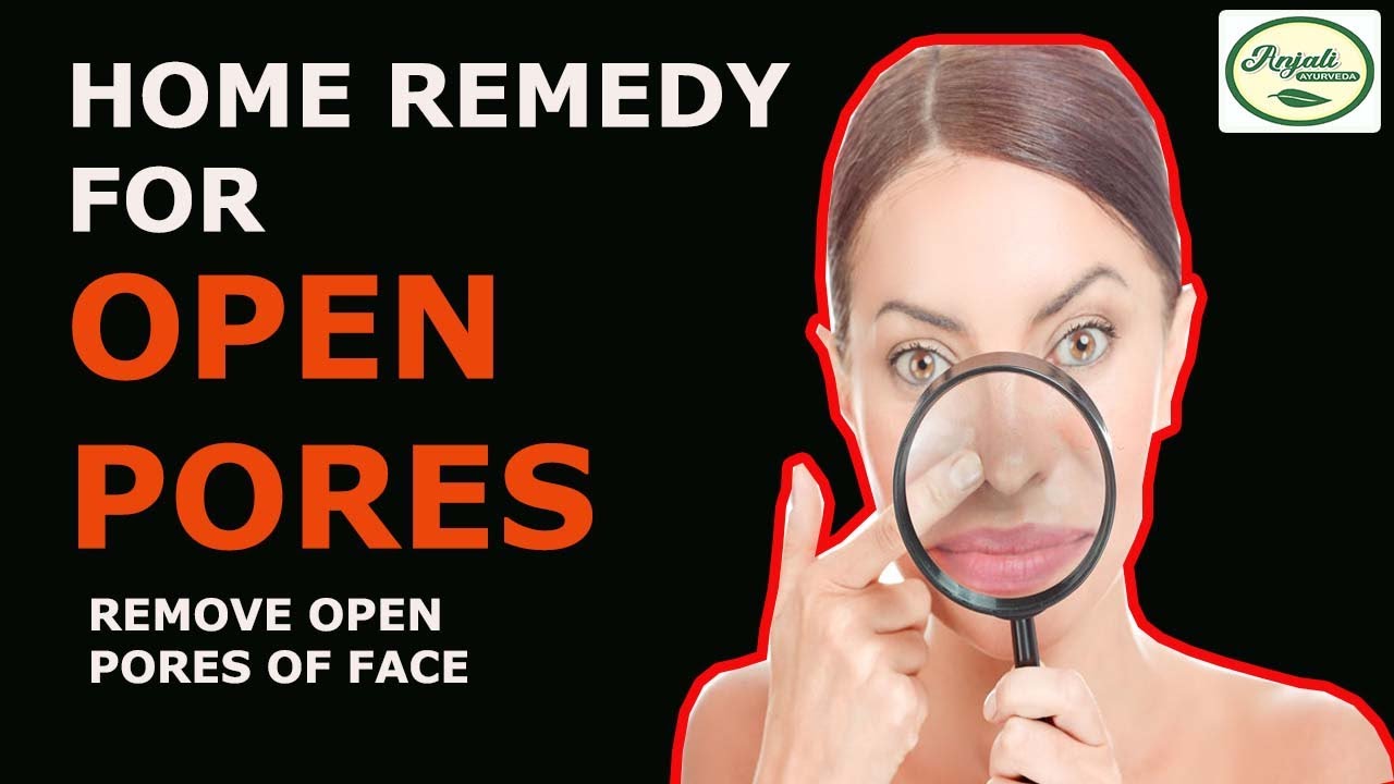 Get rid of open face pores | How to get rid of open pores instantly ...