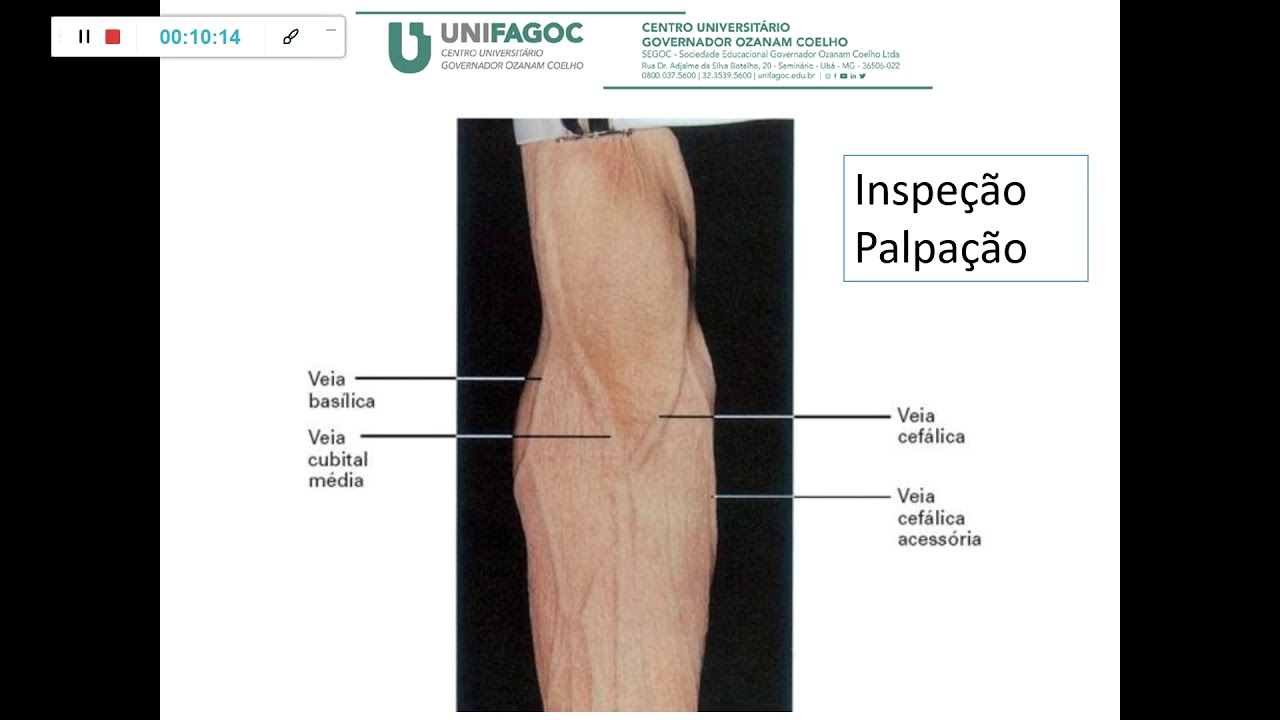 Punção Venosa Periférica (Introdução) ENF 304- UNIFAGOC. - YouTube