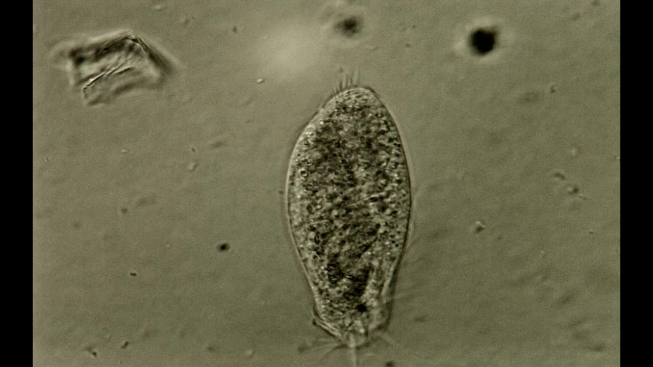 Large Ciliate - YouTube