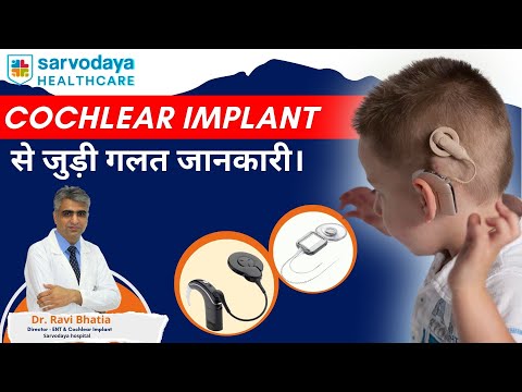 Misconceptions about Cochlear Implants | #cochlear #implant #ears #hearing #earproblems #doctor