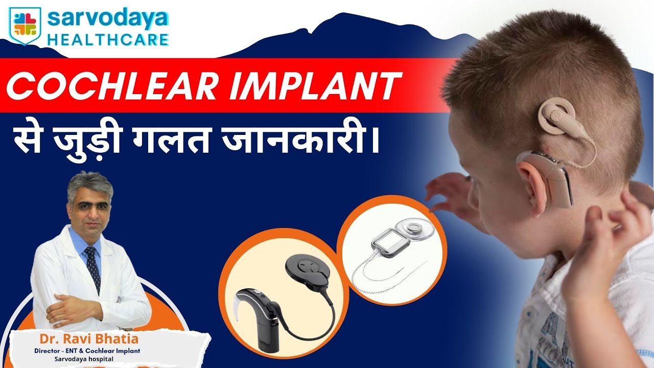 Cochlear Implant से जुड़ी गलत जानकारी। | #cochlear #implant #ears # ...
