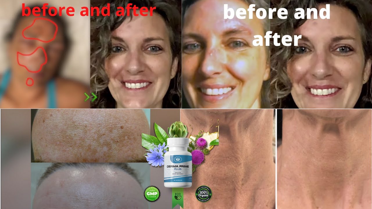 DermaPrime Plus:Derma Prime Plus full Review 2021 for skincare - YouTube