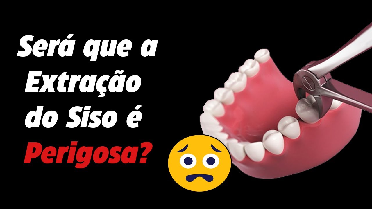 Extração de Siso – Descubra Como é Feita e Qual o Passo a Passo da ...