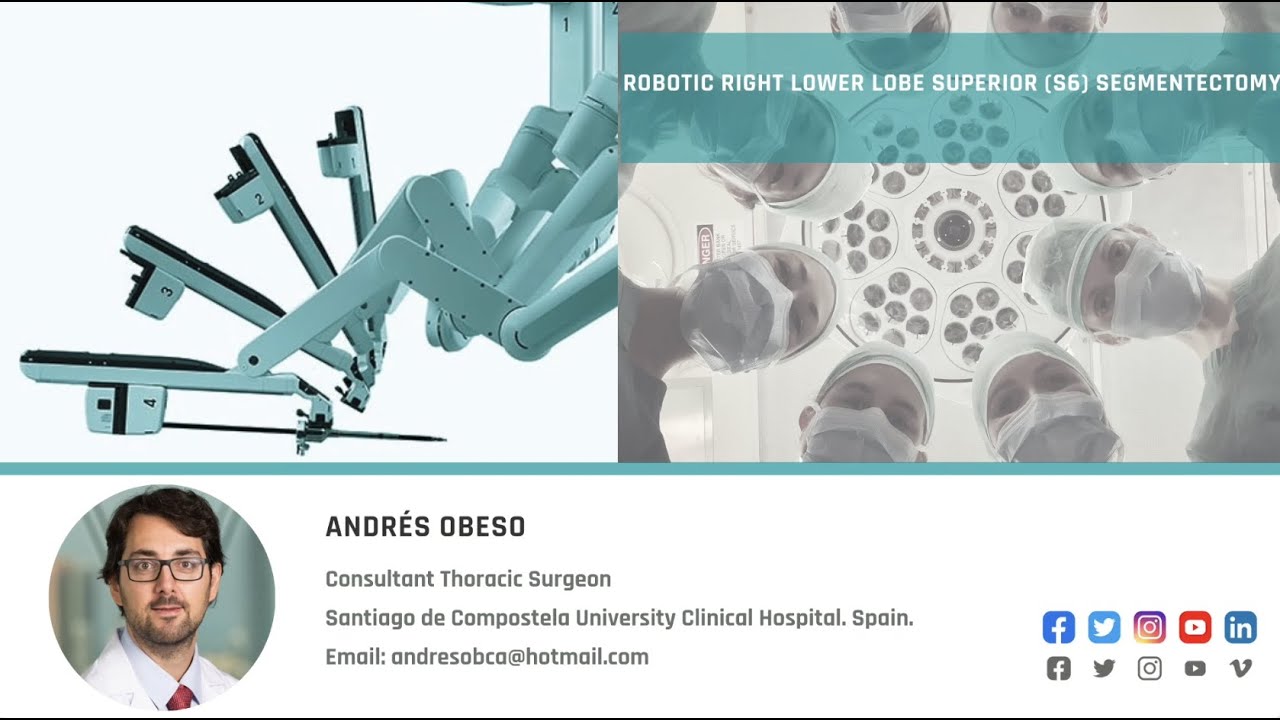 Robotic Right Lower Lobe Superior S6 Segmentectomy Youtube