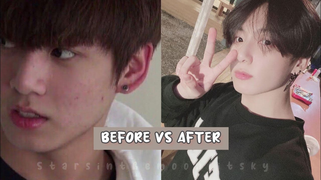 Jungkook’s Secret Skin Care Tips To Remove Acne & Pimples & get Clear ...