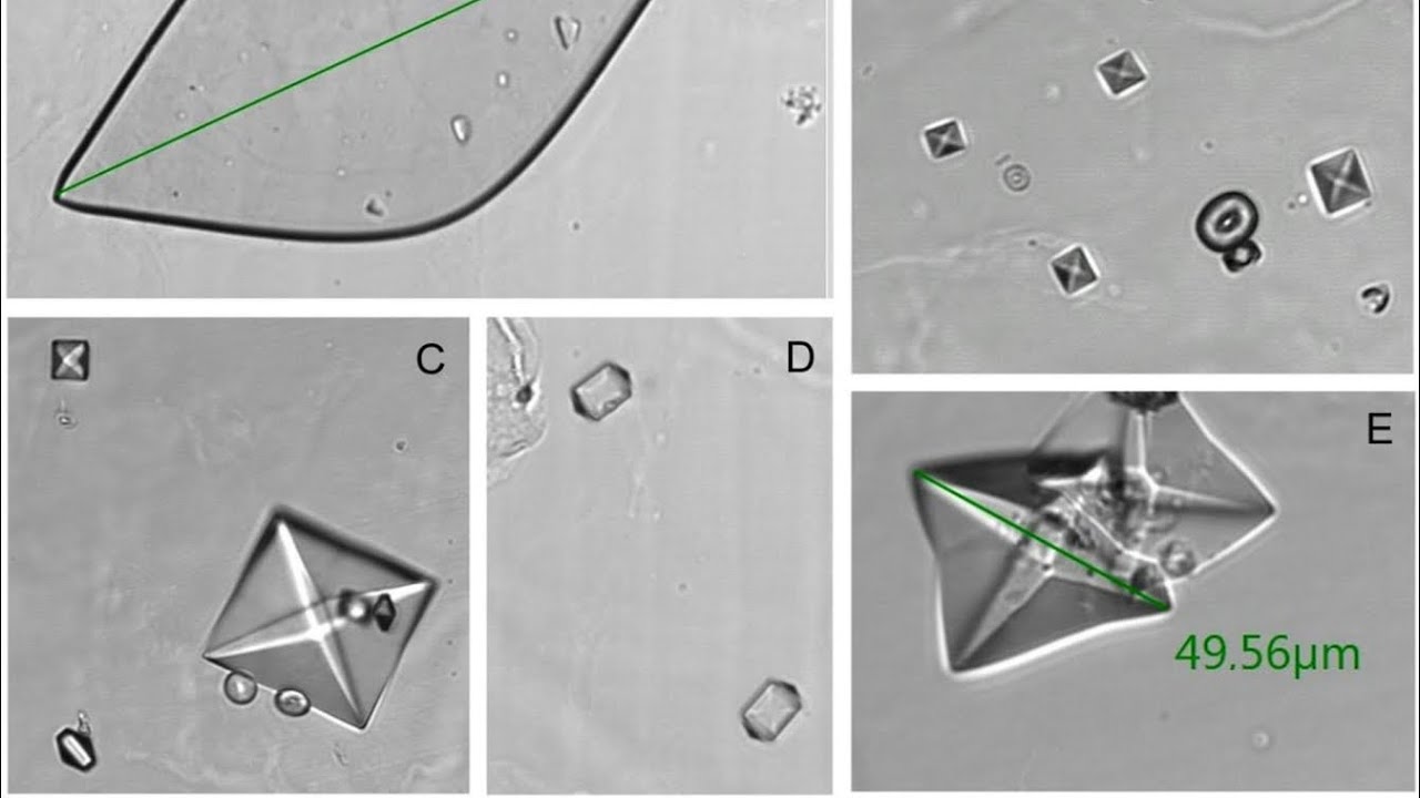 Urine Analysis Part (2) (Sediment and Stain & Microscopy ) - YouTube