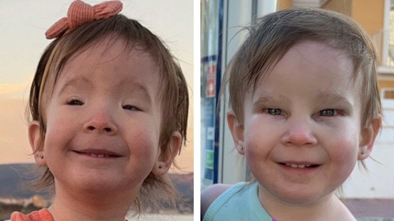 Toddler born visually impaired opens her eyes properly thanks to ...