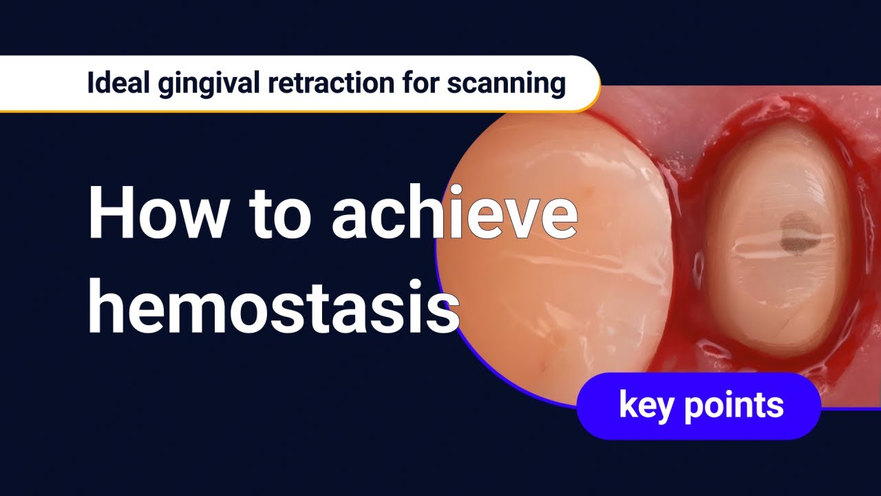 How to achieve hemostasis - YouTube