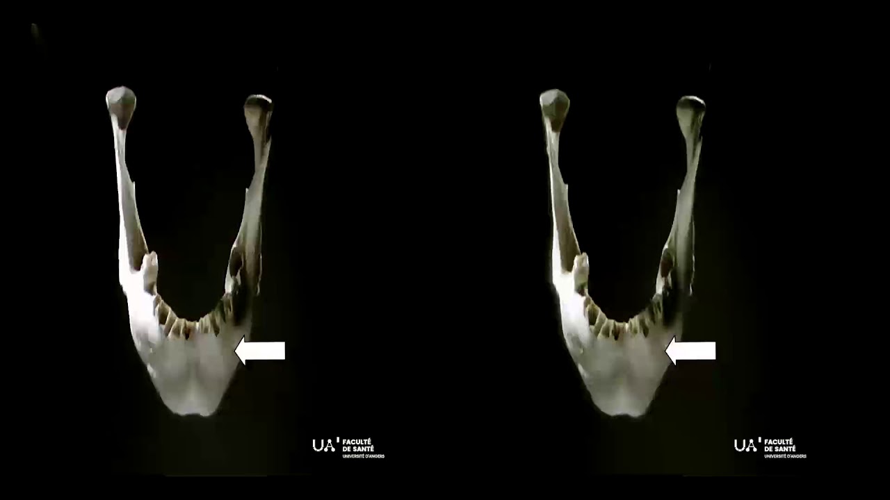 Anatomie de l'os mandibulaire 3D VR - YouTube