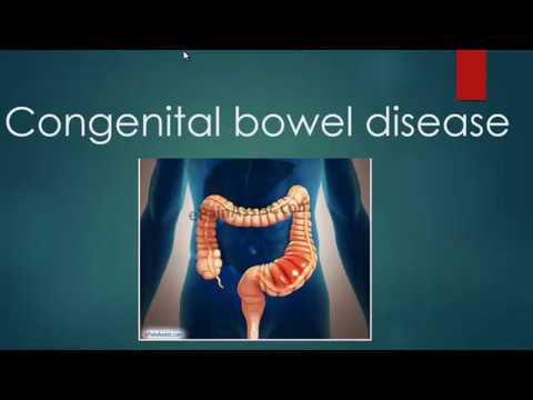 congintal bowel disease - YouTube