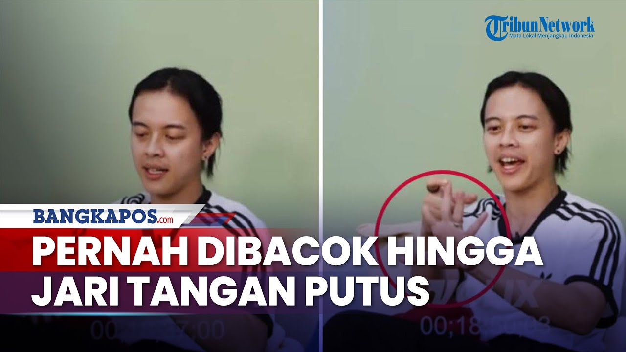 PERNAH Dibacok Geng Motor, Bisma SMASH Gemetar Tunjukkan Jari Tangannya ...