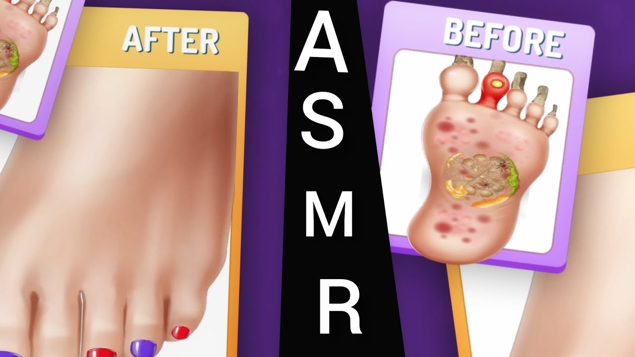 foot treatment (CLEANING ) #asmr #satisfying - YouTube