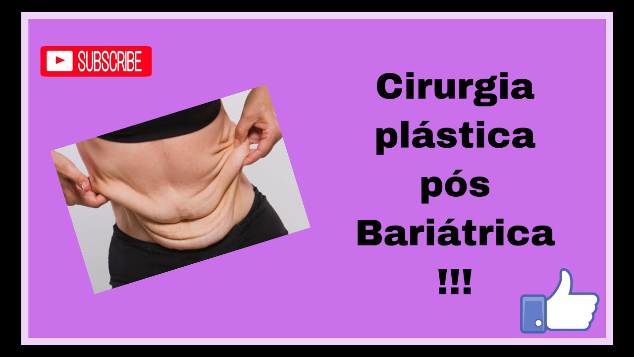 Cirurgia plástica pós bariátrica!!!!! Abdominoplastias - YouTube