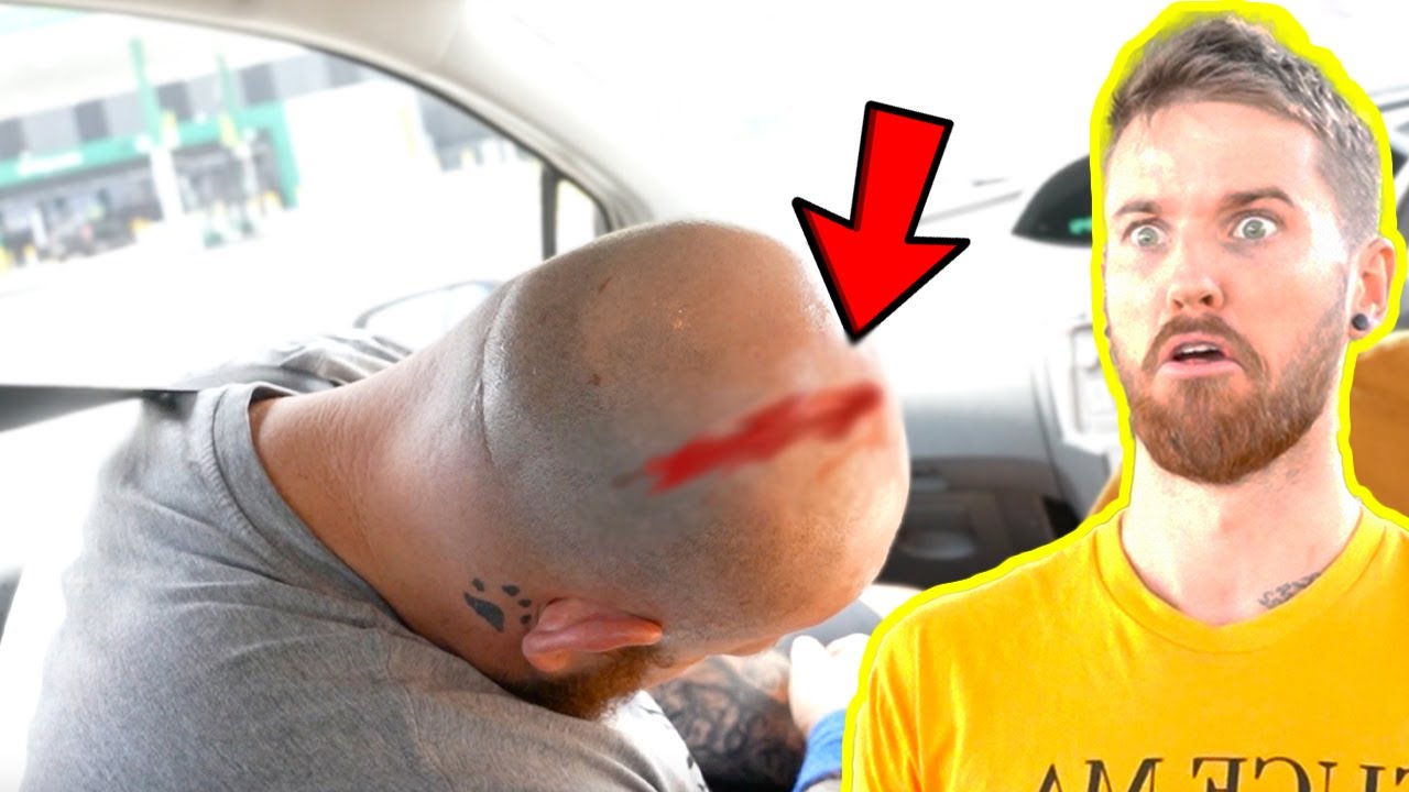 He Cut His Head Open! - YouTube