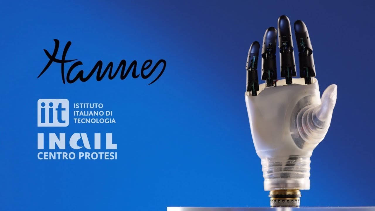 Hannes prosthetic hand - YouTube