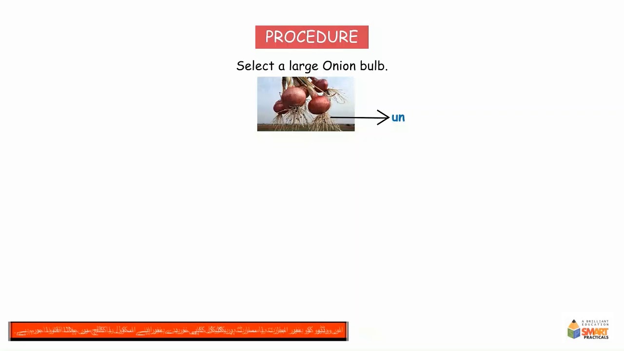 5.2: Preparation of root tip squashes and study stages of mitosis ...