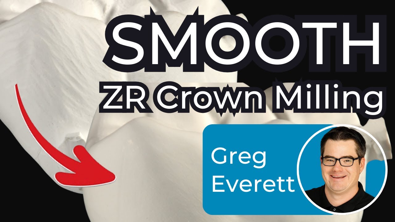 Eliminate bad surface finish with your Dental Milling with Greg Everett ...