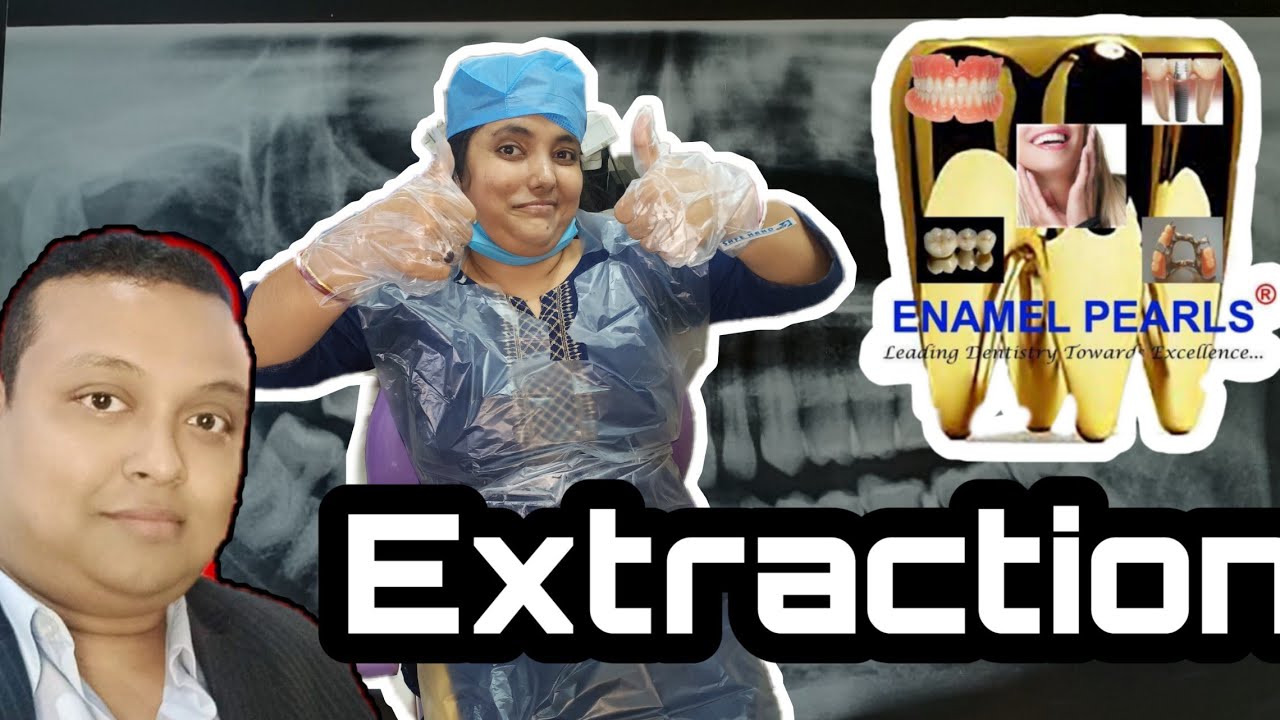 Painless||Tooth Extraction ||@Enamel pearls specially dental clinic ...