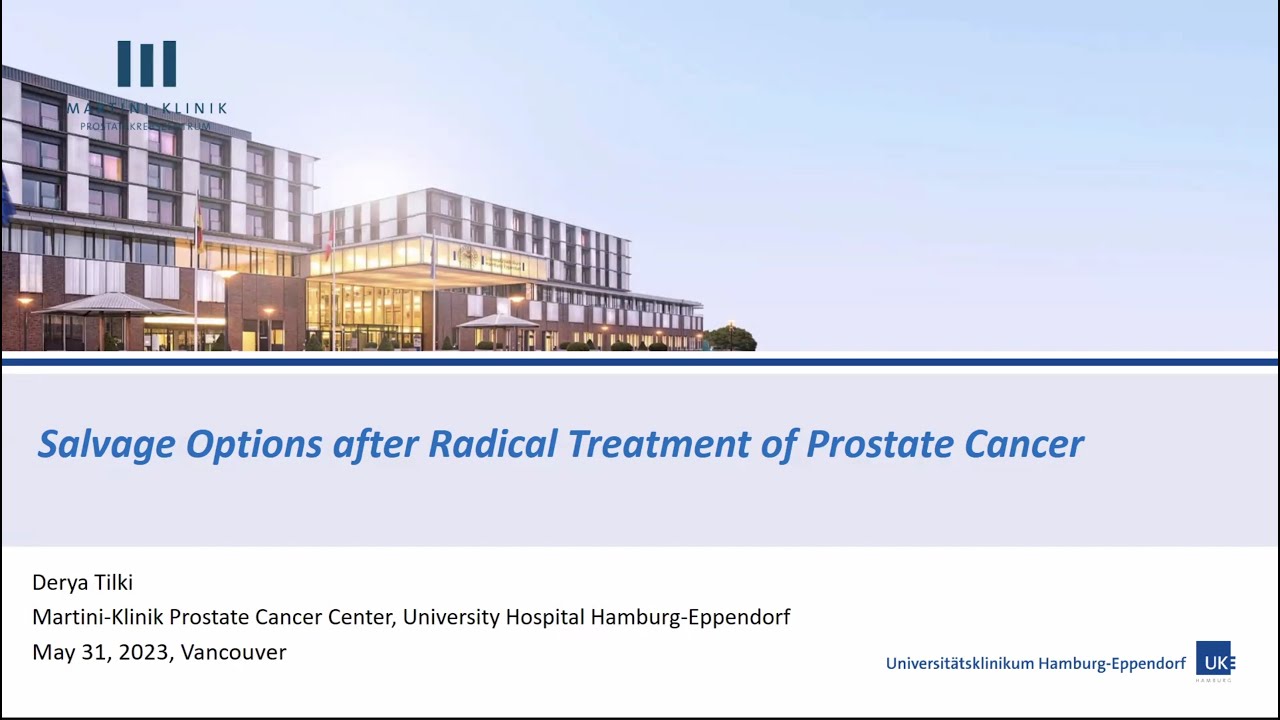 Salvage Options After Radical Treatment of Prostate Cancer - YouTube