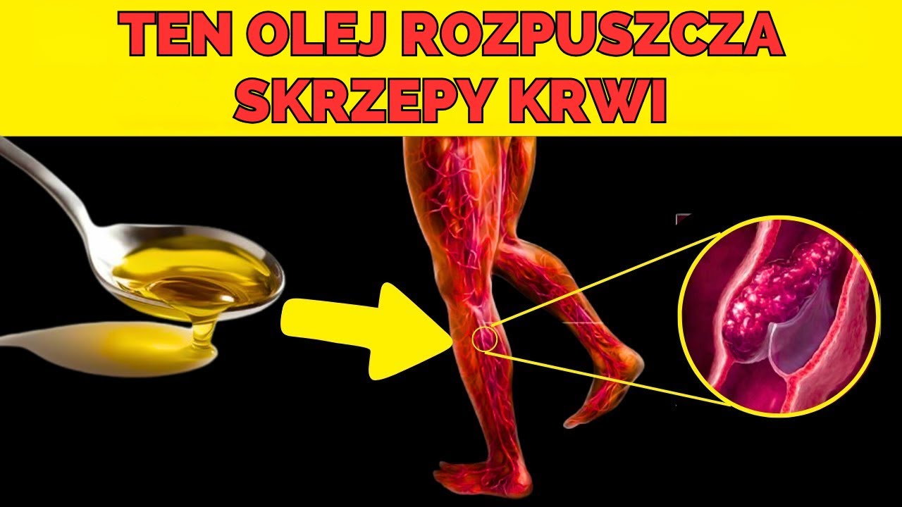 Rozpuszczaj skrzepy krwi w naturalny sposób: 6 najpotężniejszych olejów ...