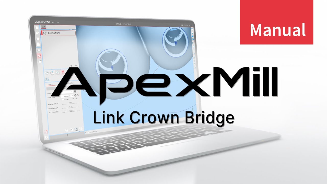ApexMill_Link Crown Bridge (KR) - YouTube