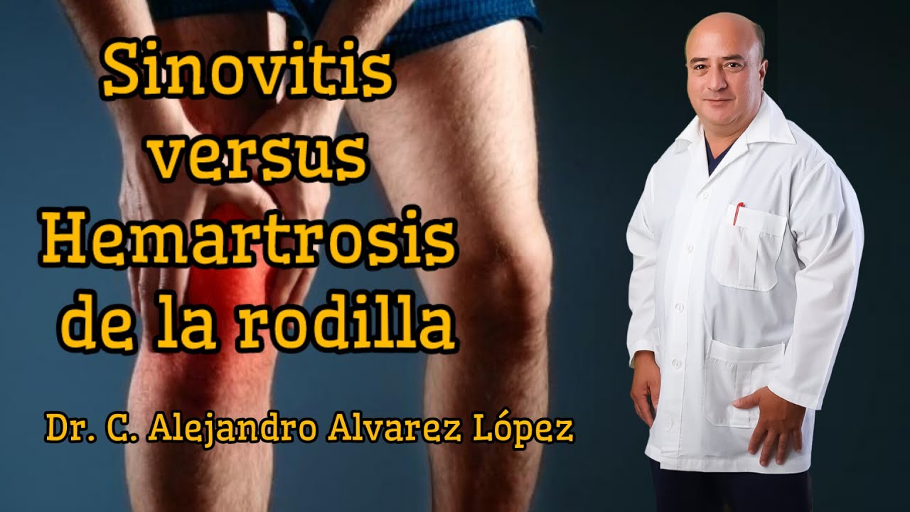 Sinovitis versus hemartrosis de la rodilla - YouTube