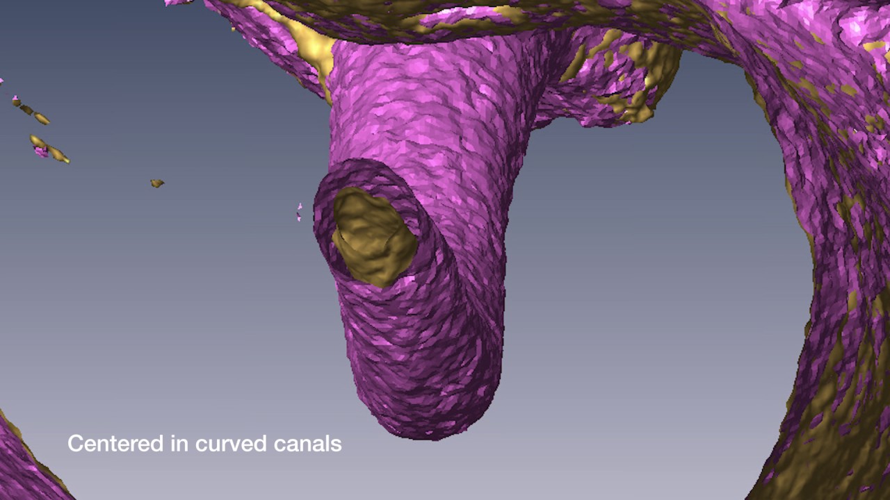 VDW Dental · Grande & Plotino: RECIPROC centering ability in curved ...
