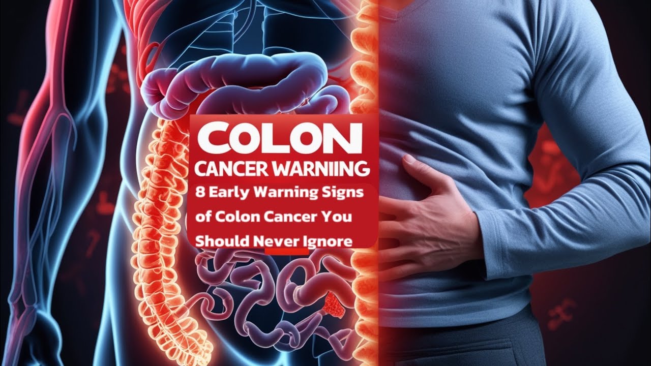 8 Early Warning Signs of Colon Cancer You Should Never Ignore - YouTube