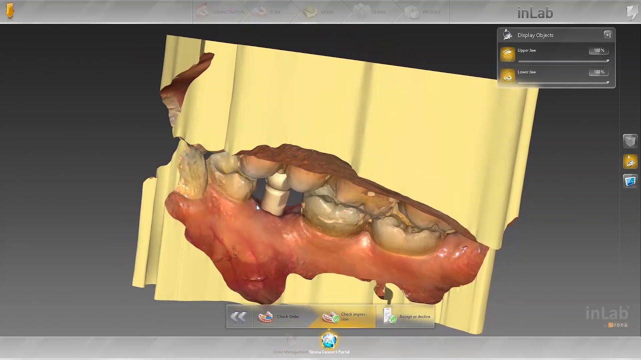 How to: Import Cerec to Exocad/3Shape - YouTube