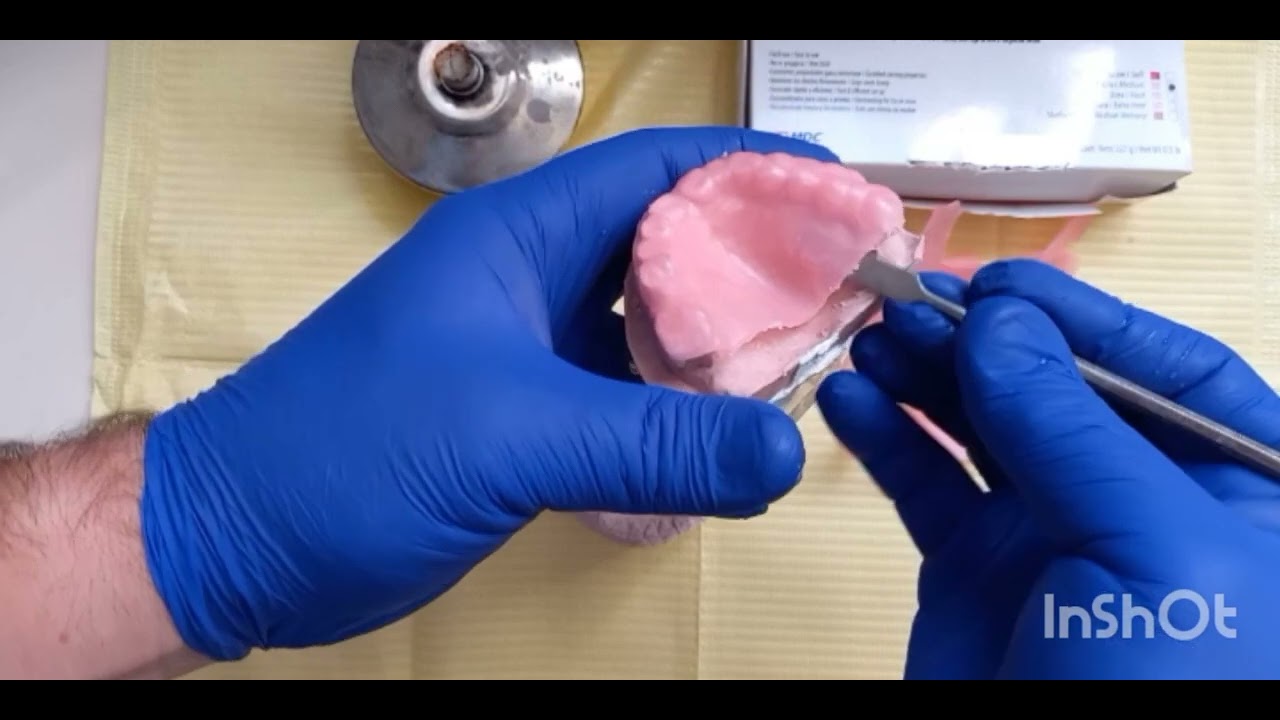 REGISTRO DE MORDIDA EN CERA, PARA MONTAJE EN ASA DEL MODELO INFERIOR ...