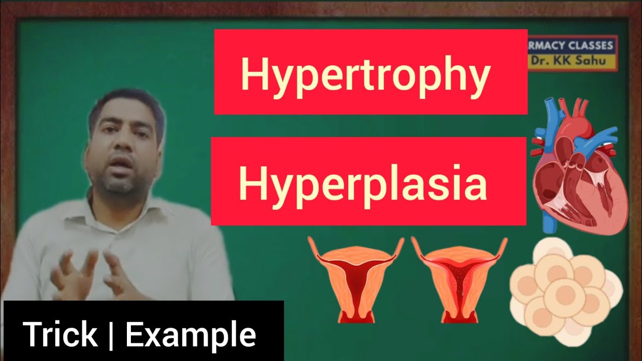 Confusing terms (P-16) Hypertrophy Vs Hyperplasia - YouTube