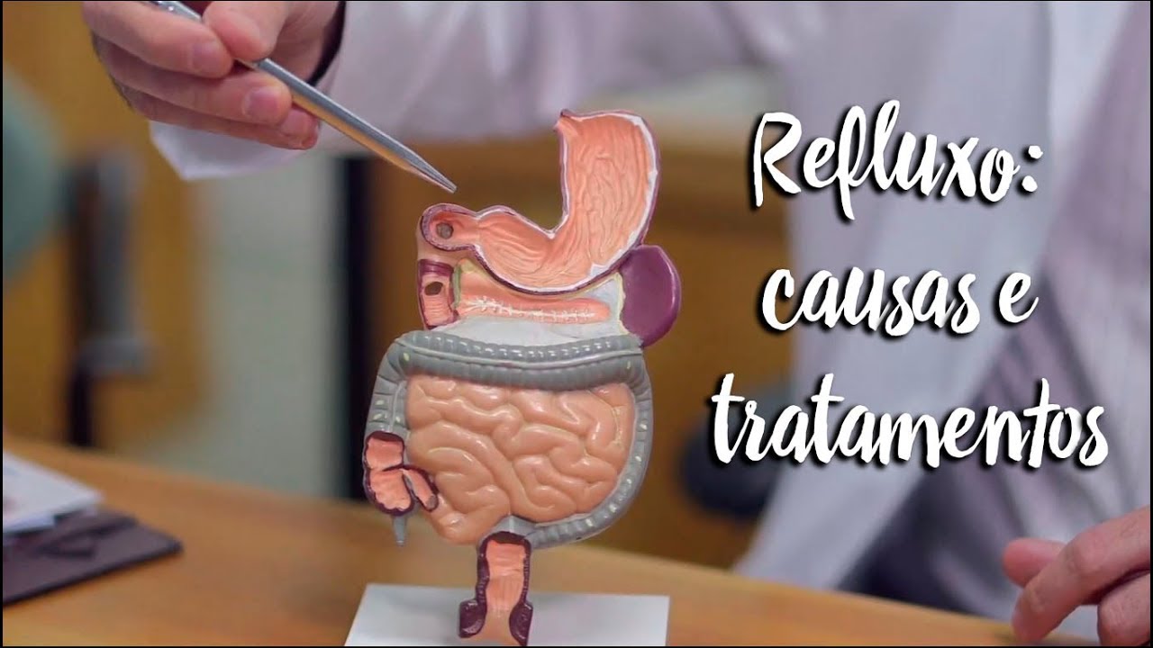 Refluxo: causas e tratamentos - by Farmácias Pague Menos - YouTube