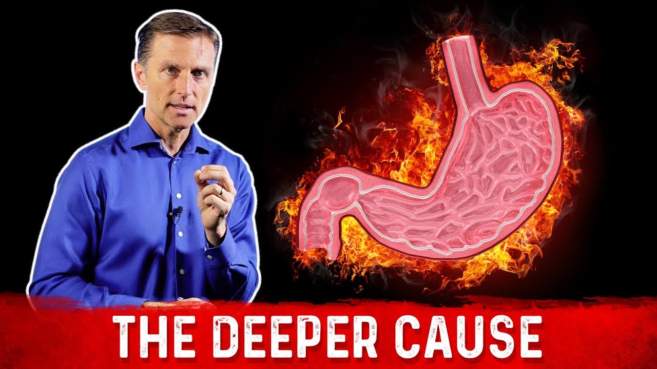 The Real Causes Of Acid Reflux Heartburn GERD Dr Berg YouTube the-real-causes-of-acid-reflux-heartburn-gerd-dr-berg-youtube