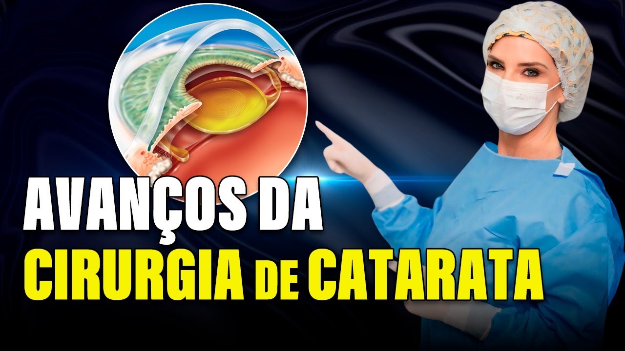 Os Mais Recentes Avanços na Cirurgia de Catarata: O Que Você Precisa ...