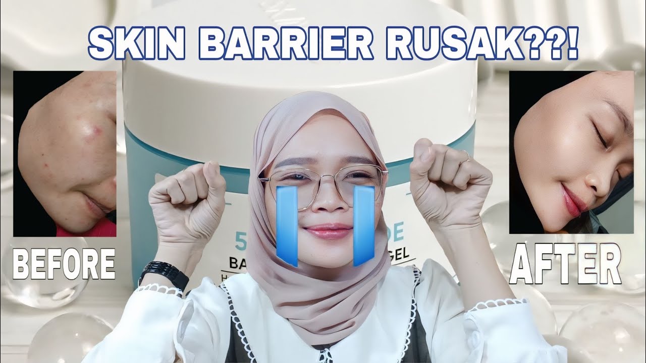 CARA MENGATASI SKIN BARRIER RUSAK DENGAN MOISTURIZER SKINTIFIC - YouTube