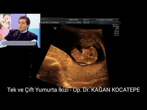 TEK VE ÇİFT YUMURTA İKİZLERİ NASIL OLUŞUR? ARALARINDAKİ BENZERLİKLER VE FARKLILIKLAR NELERDİR?