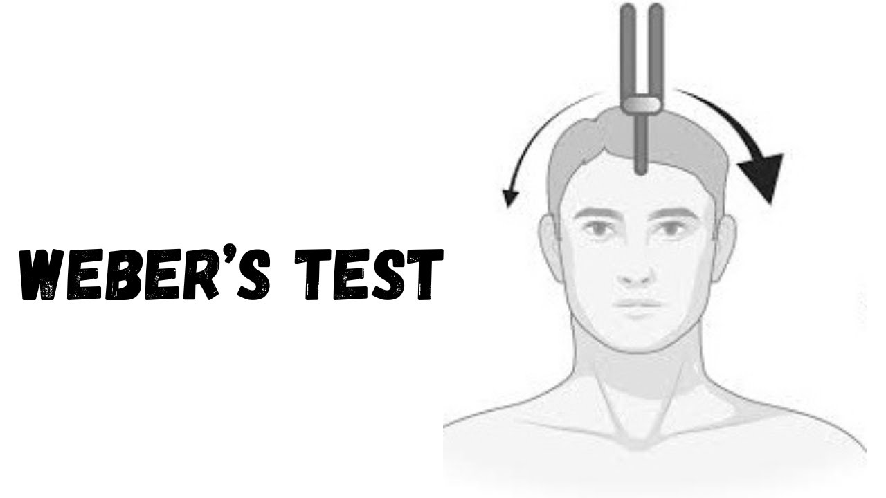 Weber’s Test | Clinical Examination | Ent - YouTube