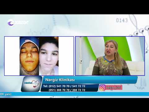 Mezoterapiya, dəri xəstəlikləri - Həkim İşi 19.04.2019