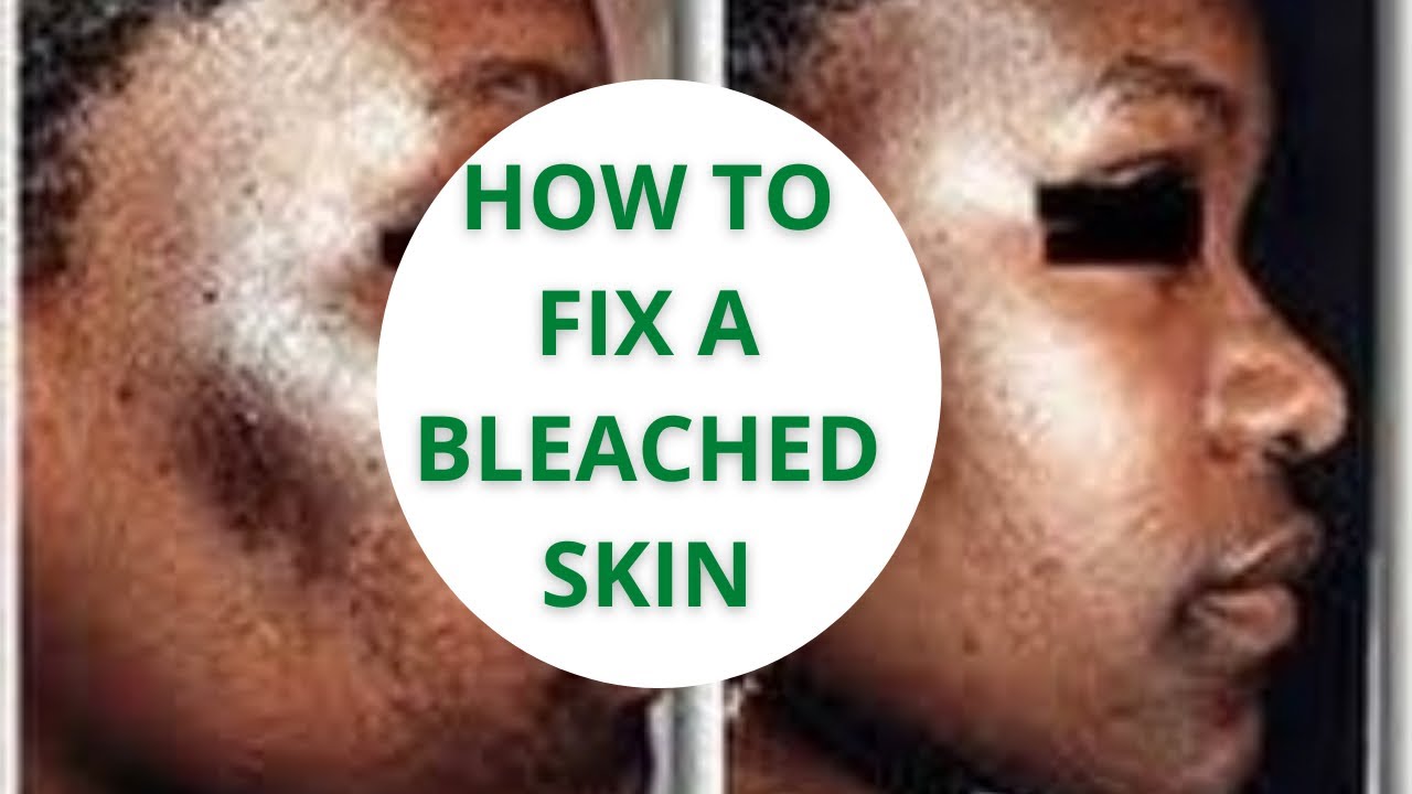 How to repair a damaged bleached skin | What you should do if you ...