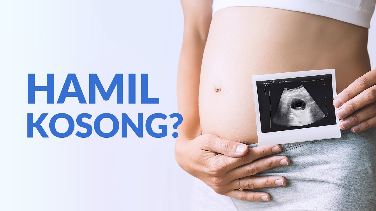 Positif Hamil tapi Tidak Ada Janin, Bisa Jadi Itu Kehamilan Kosong ... Positif Hamil tapi Tidak Ada Janin, Bisa Jadi Itu Kehamilan Kosong ...