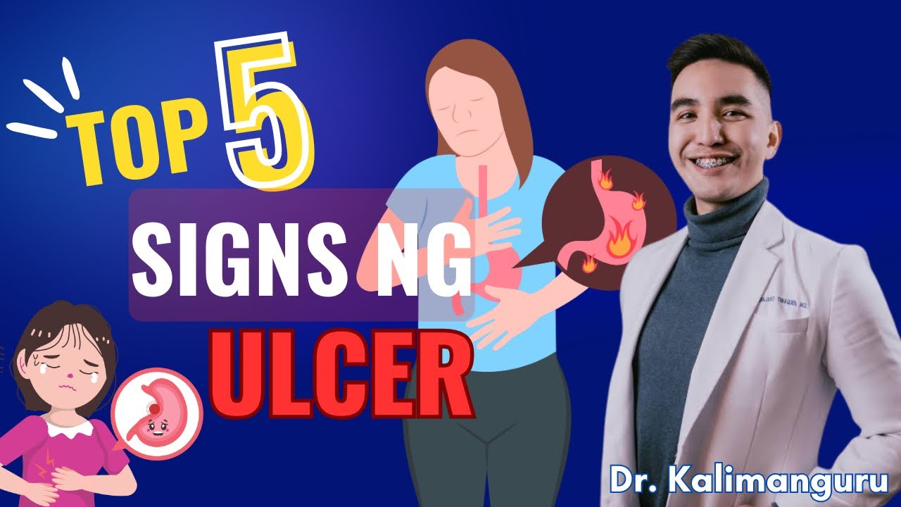 SINTOMAS NG ULCER ( SIGNS OF ULCER ) | Dr. Kalimanguru Channel - YouTube