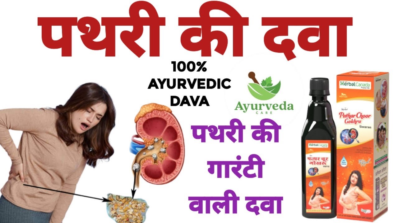 पथरी की गारंटी वाली दवा |kidney stone |stone pathri| Kidney stone ...
