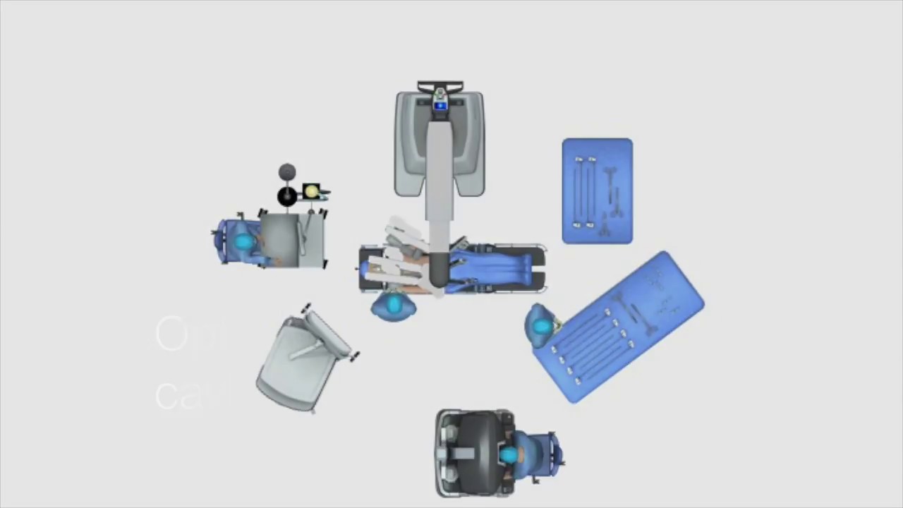 Extraperitoneal retrorectus incisional hernia repair with suprapubic ...