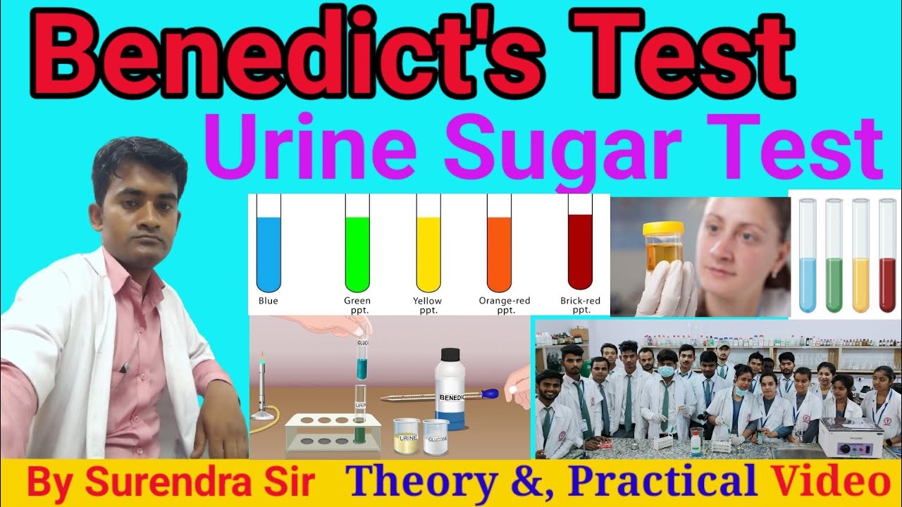 Benedict's Test | Benedict's Test Practical|| Urine Sugar Theory ...