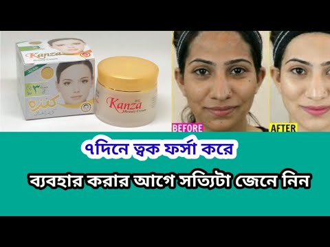 ত্বক ফর্সাকারী ক্রিম | সঠিক তথ্য জেনে নিন || Kanza Beaury Cream review