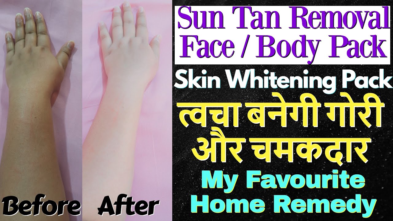 Easy Sun tan removal home remedies / How to remove tan from skin / tan ...